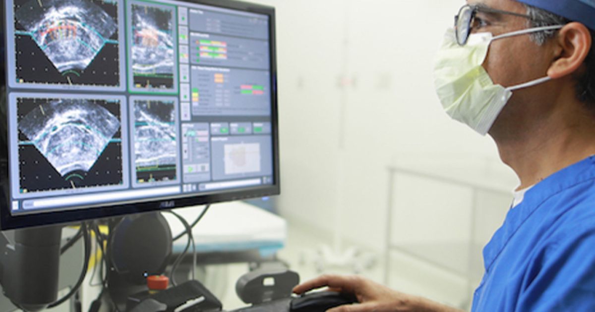Ultrasound and High Intensity Focused Ultrasound | ZERO Prostate Cancer