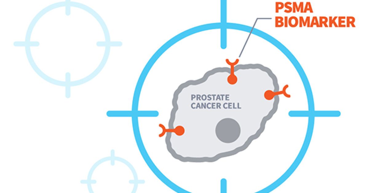 Advances in Biomarker Testing | ZERO Prostate Cancer