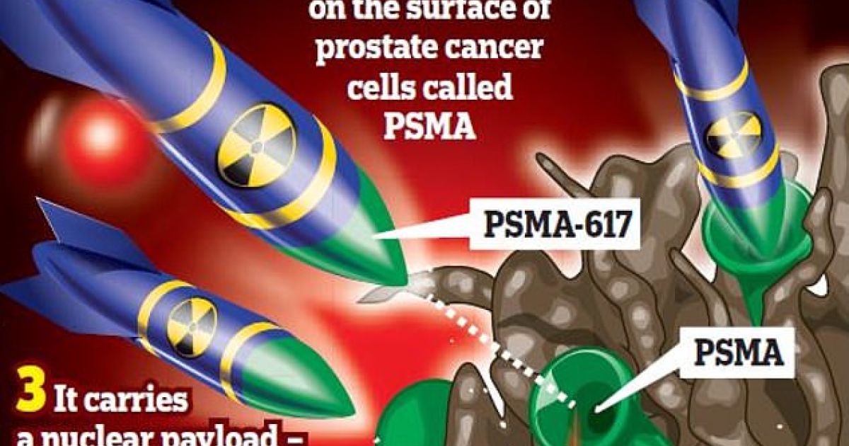 Prostate cancer breakthrough: New treatment to 'seek and destroy ...