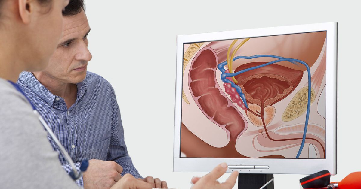 Boston Scientific Webinar Series 2024: Part One | ZERO Prostate Cancer Boston Scientific Webinar Series 2024: Part One | ZERO Prostate Cancer